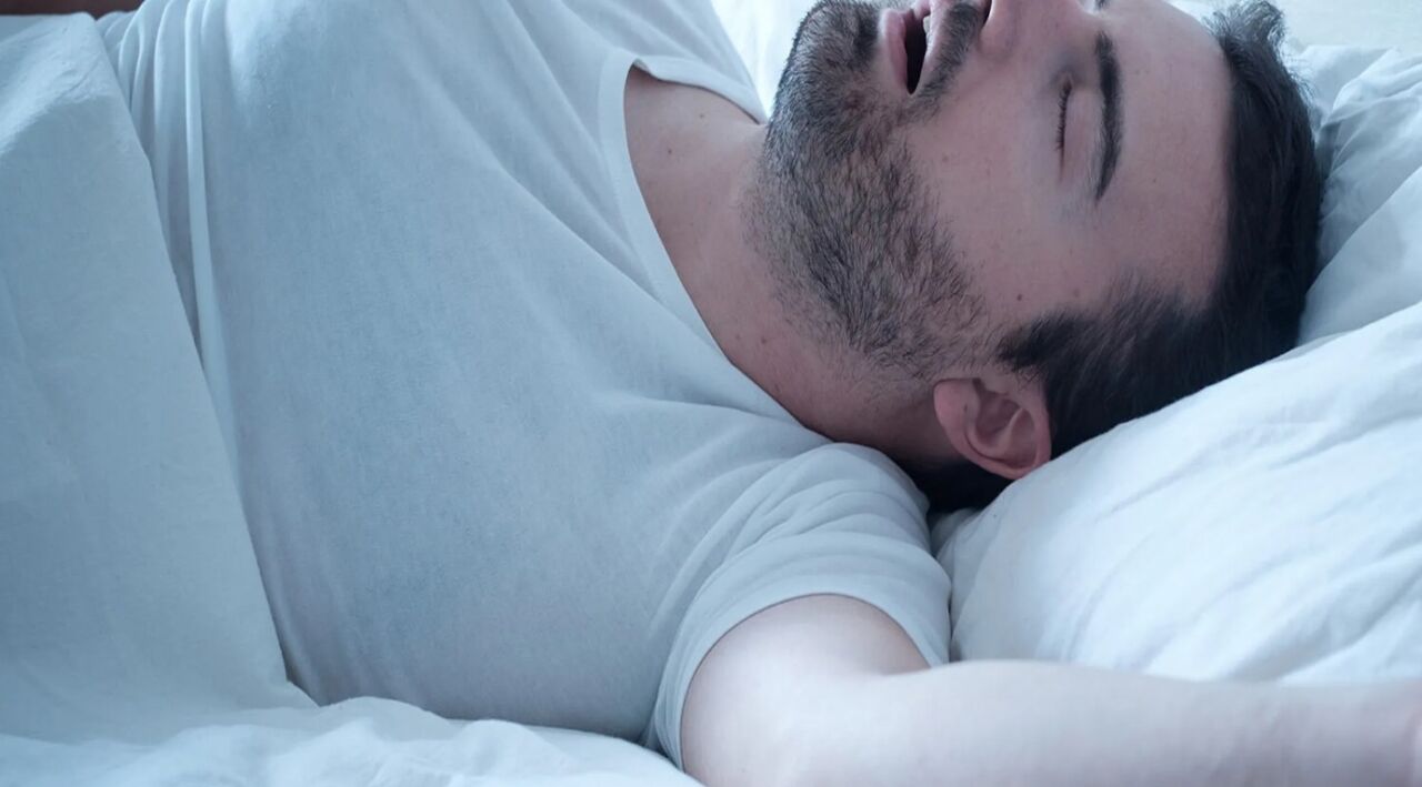 Obstructive Sleep Apnea | Sleep Apnea Surgery (OSA)